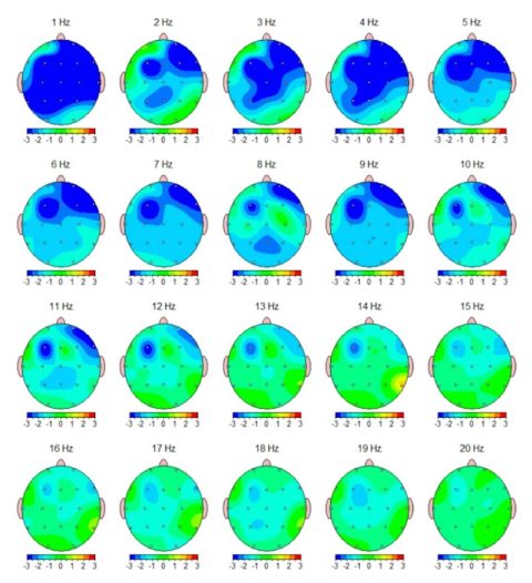 Home EN - Brainwell Medical