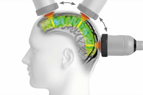 Medical Services - TPS Brainwell+ - Brainwell Medical