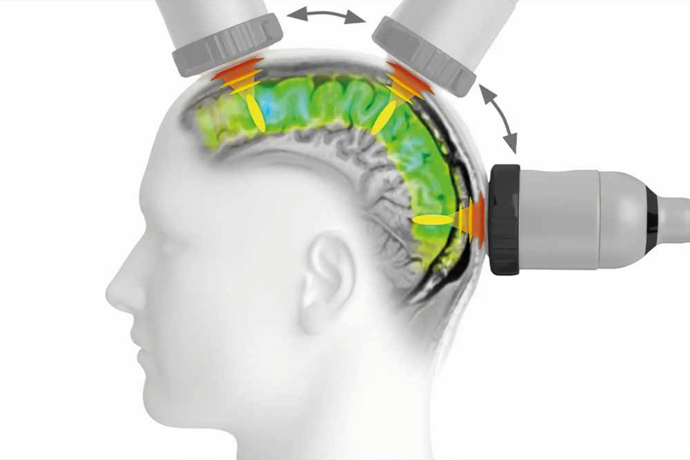 Medical Services - TPS Brainwell+ - Brainwell Medical